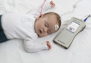 Best Practices for Pediatric Auditory Brainstem Response (ABR ...